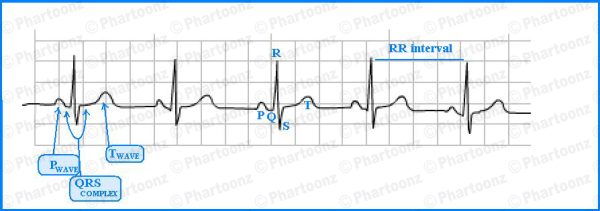 How to Read ECG basic common Charts - Phartoonz