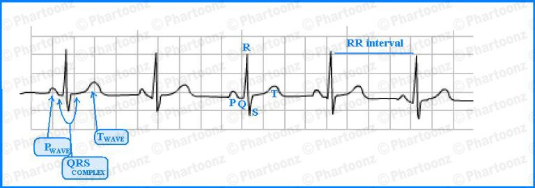 How to Read ECG basic common Charts - Phartoonz