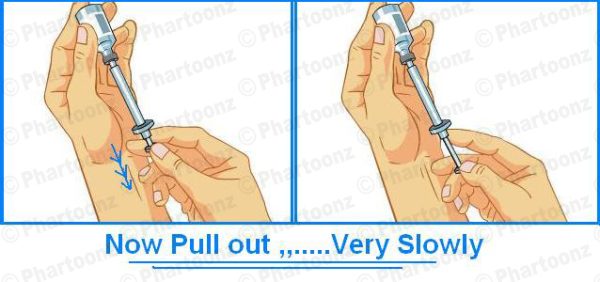 How to Give an insulin Injection - Phartoonz