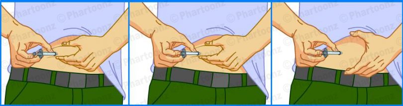 How to Give an insulin Injection - Phartoonz